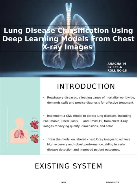 Lung Disease Classification Using Deep Learning Models From Chest X Ray