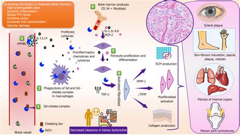 Nephrogenic Systemic Fibrosis Causes Symptoms Diagnosis
