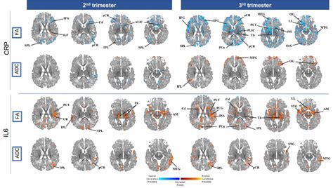Association Between Diffusion Tensor Imaging Dti Fractional Download Scientific Diagram