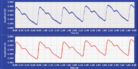 Photoplethysmogram Ppg Top Detected Raw Signal Bottom Filtered