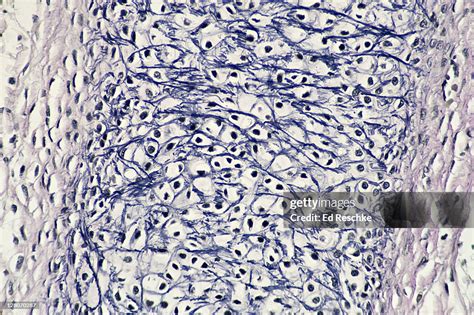 Supporting Tissue