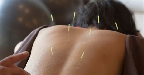 How Exactly Does Acupuncture Work