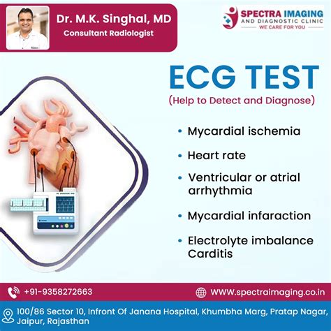 Spectra 📢 Get Your Heart Checked With An Ecg Test ️ 👉🏻