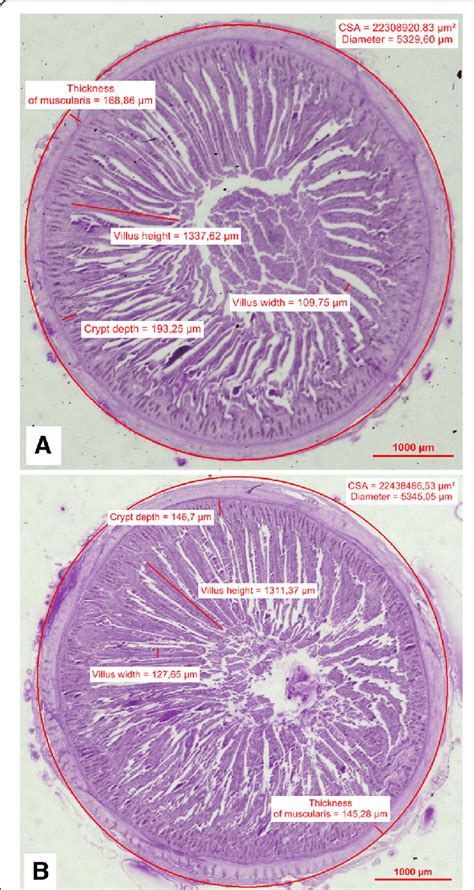 A Photomicrograph Light Microscope Of The Duodenum Csa Diameter