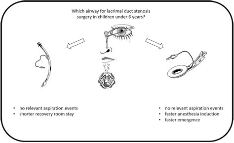 Laryngeal Mask Airway Vs Endotracheal Tube 7 Hundred Endotracheal