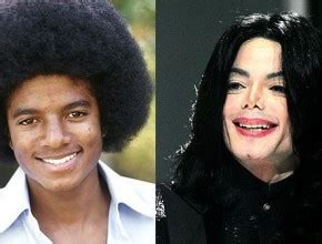 Michael Jackson Before And After Plastic Surgery Celebrity Plastic