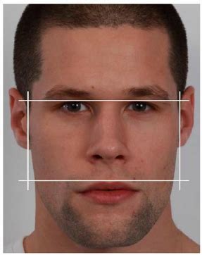 Example Of Relative Facial Width Measure An Example Illustrating How