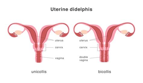 Bicornuate Uterus Over 35 780 Royalty Free Licensable Stock