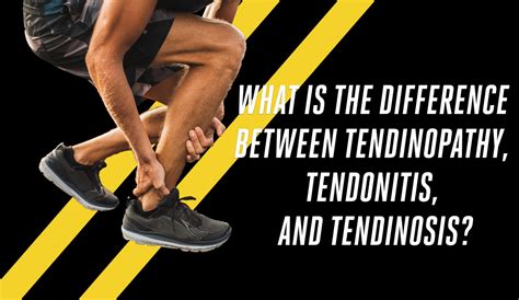 What Is The Difference Between Tendinopathy Tendonitis And Tendinosis — Recoverfit