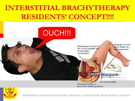Physics And Clinical Aspects Of Interstitial Brachytherapy Ppt Skin