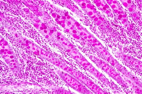 Small Intestine Duodenum And Vermiform Appendix Human Under The Microscope Stock Image Image