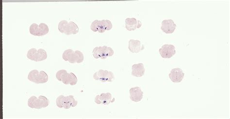 Pitx2 Rna In Situ Gene Expression Assay Gxd