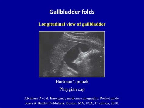 Ultrasound Of The Gallbladder Pptx Digestive Disorders Diseases