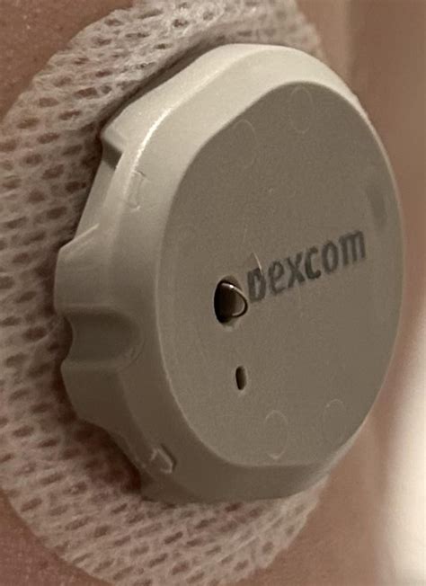 Is This A Normal Amount Of Bleeding From Insertion Placed On Back Of Right Arm R Dexcom