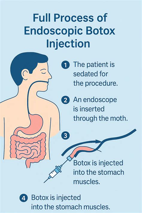 Botox Injection For Gi Disorders Melbourne Gastroenterologist