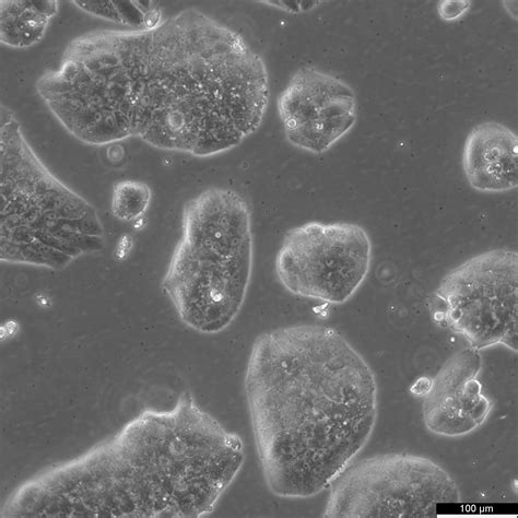 Mda Mb 468 Cells