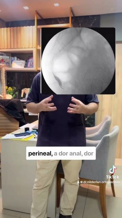 Dor No Cóccix Bloqueio Do Gânglio ímpar Dr Nilderlan Lino Inmed