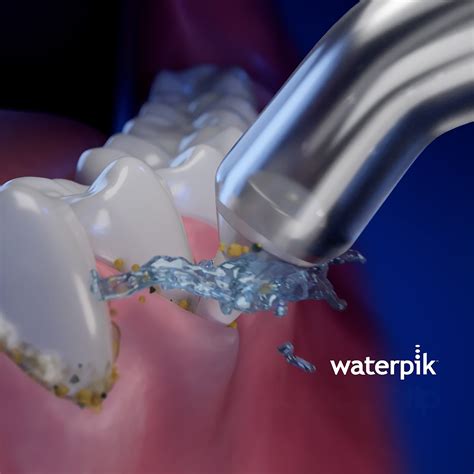 Pik Pocket™ Water Flosser Tip Pp 100e Replacement Tips