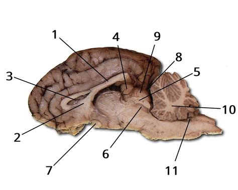 Sheep Brain Model Diagram Quizlet