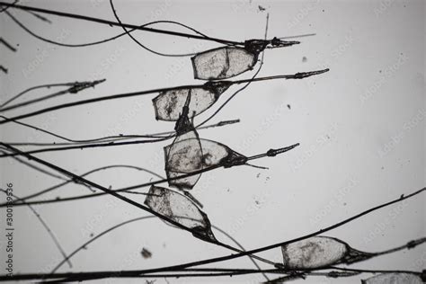 Lice Egg Attached To The Hair Photo Taken With A High Magnification