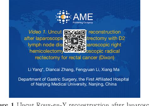 Figure 1 From Simultaneous Laparoscopic Distal Gastrectomy Uncut Roux