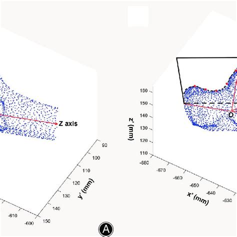 Coronoid Process Reconstruction And Anatomical Parameters Definition