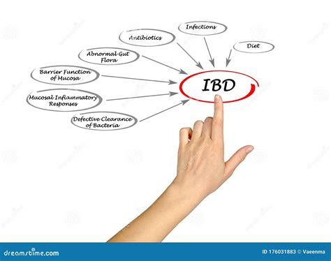 Inflammatory Bowel Disease Stock Image Image Of Concept 176031883