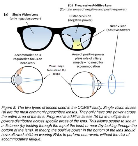 The Science Behind Myopia By Brittany J Carr And William K Stell