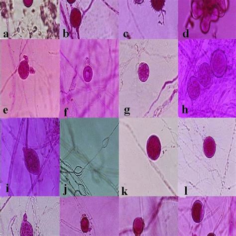 Sexual And Asexual Organs Of Pythium Species Isolated In Fars Province
