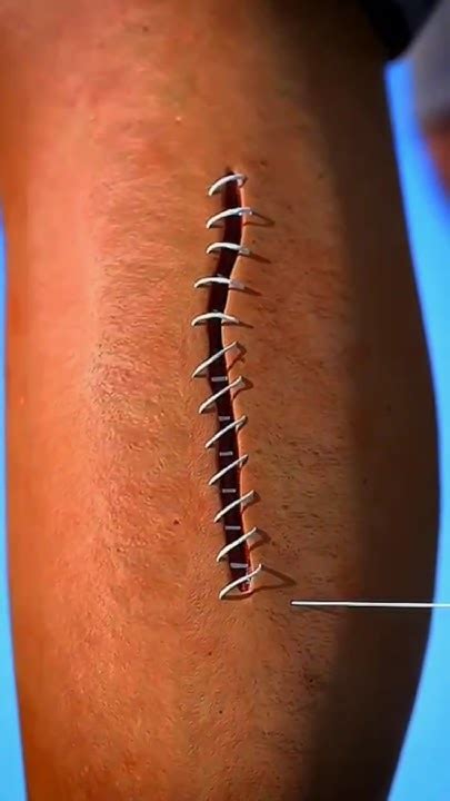 How Stitches Work Shorts Youtube