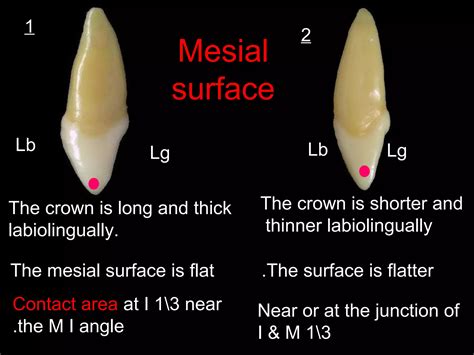 Dentition Ch 2 Incisors Ppt