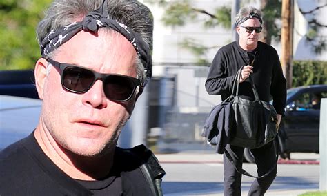 Ray Liotta Acne Scars