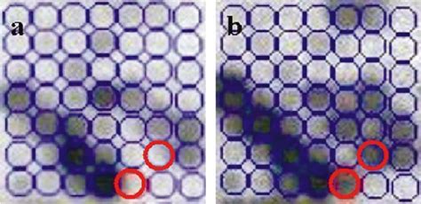 Hybridization Using Human Cdna Microarray Revealed Differential