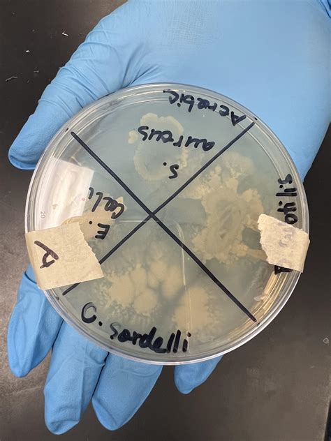 Professors Assistant Contaminated Cultures 🫣 R Agarporn