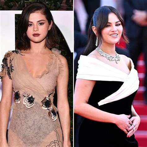 Selena Gomez Plastic Surgery Before And After Selena Gomez Teeth Then