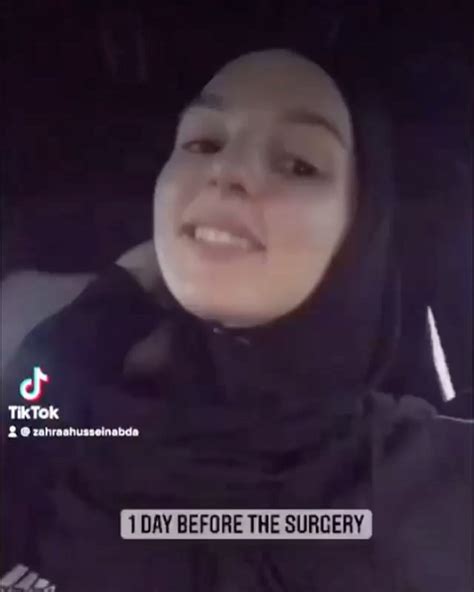 Jamil Abdallah Rhinoplasty ♥️ Zahraaabdalah Instagram