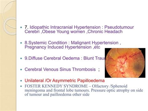 Optic Nerve Disease Pptx