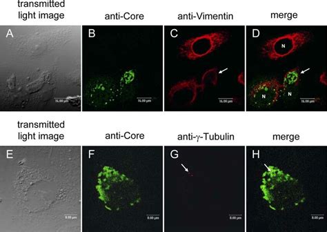Vimentin Caging And Pericentriolar Localization Of The Inclusion