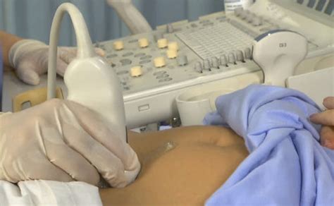 Ultrasound Imaging Simulation Module Simtics Anatomy Female Web