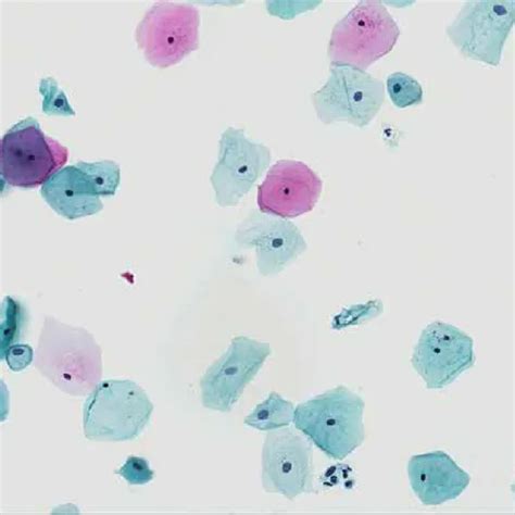 Bestscope Scanpro2 6 High Speed Full Automatic Digital Pathological