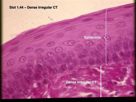 Ppt Overview Of Dense And Irregular Connective Tissues And Their