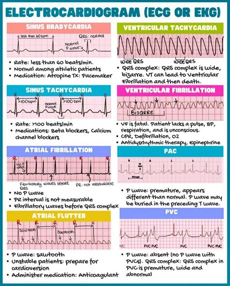 Resusmed Llc On Linkedin Ekg Cheat Sheets