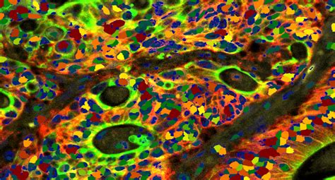 Accelerating Microscopy Image Analysis With Ai