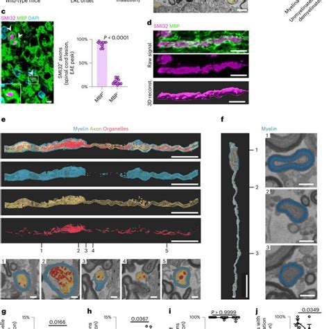 The Dynamics Of Axonal Pathology In Cpz Induced Demyelination A Left