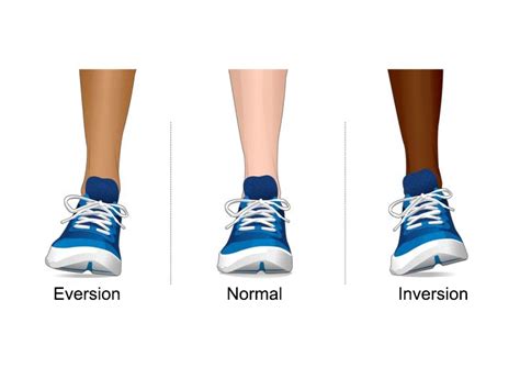 What Is Inversion And Eversion Orthotics Insoles And Eva Supplier Ideastep