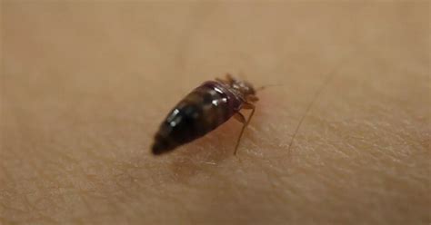 Beware Of The Bed Bugs Blood Sucking Insects On The Rampage As Call