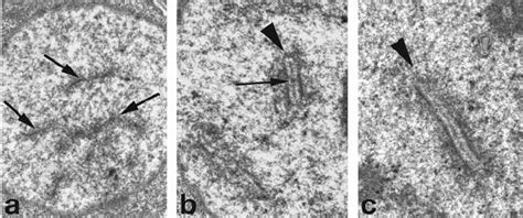 Transmission Electron Microscopy Of Arabidopsis Male Meiotic Prophase