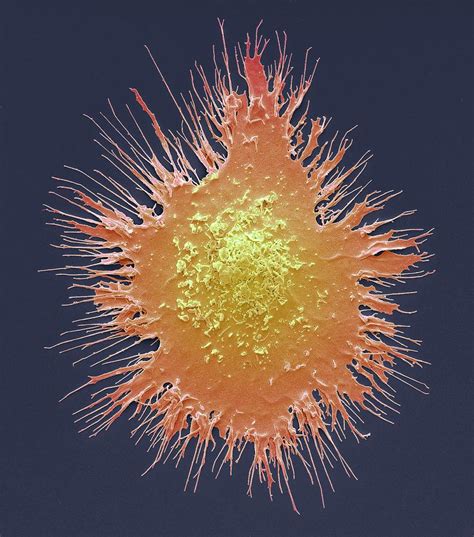 Dendritic Cell Photograph By Steve Gschmeissner Fine Art America