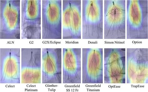 Deep Learning For Automated Classification Of Inferior Vena Cava Filter