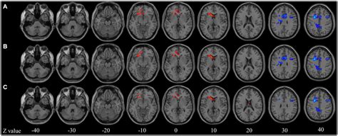 Seed Based Functional Connectivity Analysis A Age Model B Download Scientific Diagram